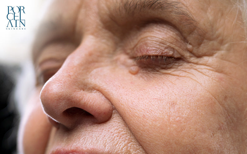 A Detailed Guide to Wrinkle Treatments | Porcelain Skin