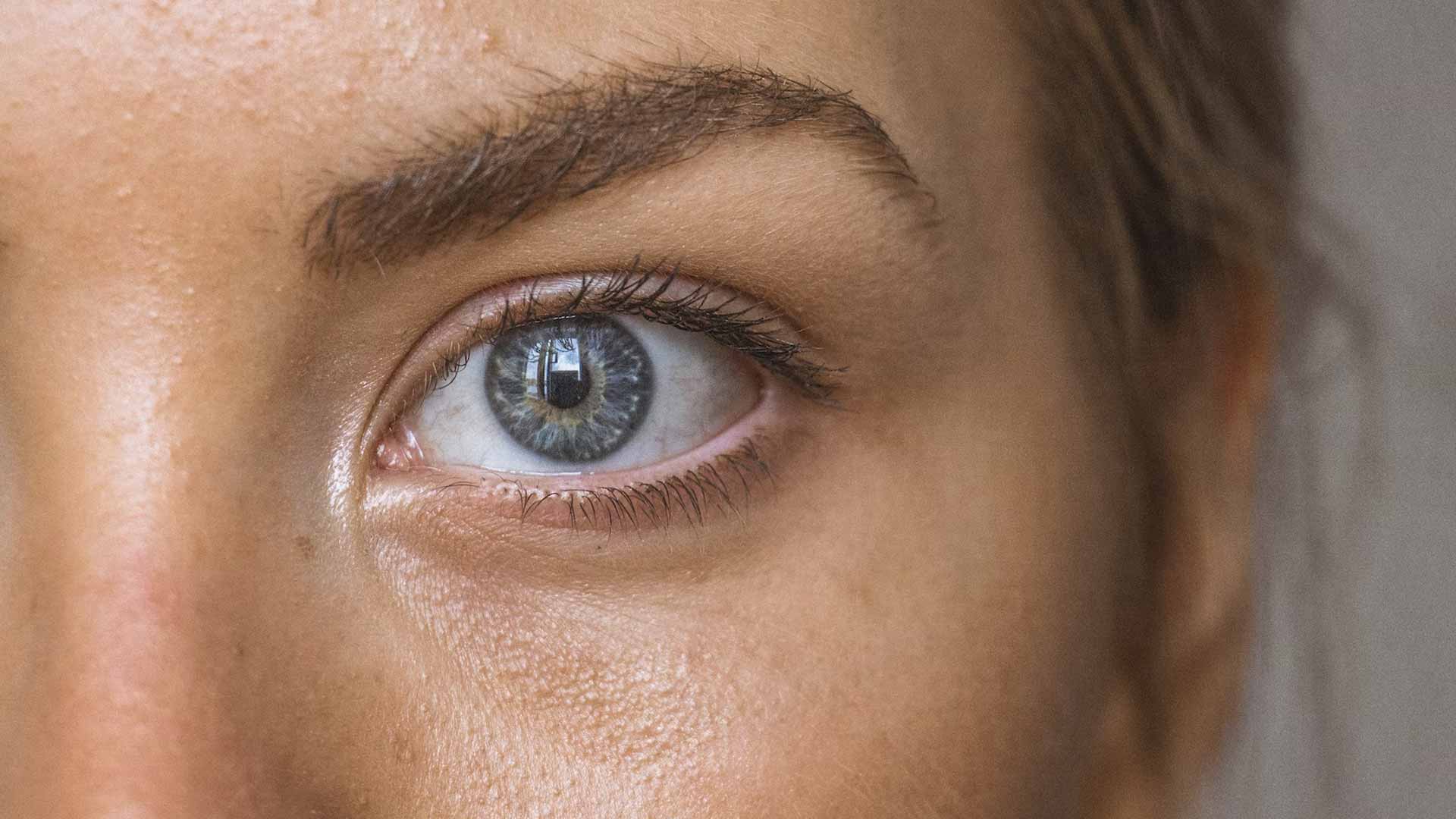 Milia Seeds 101: The Lowdown – Porcelain Skin